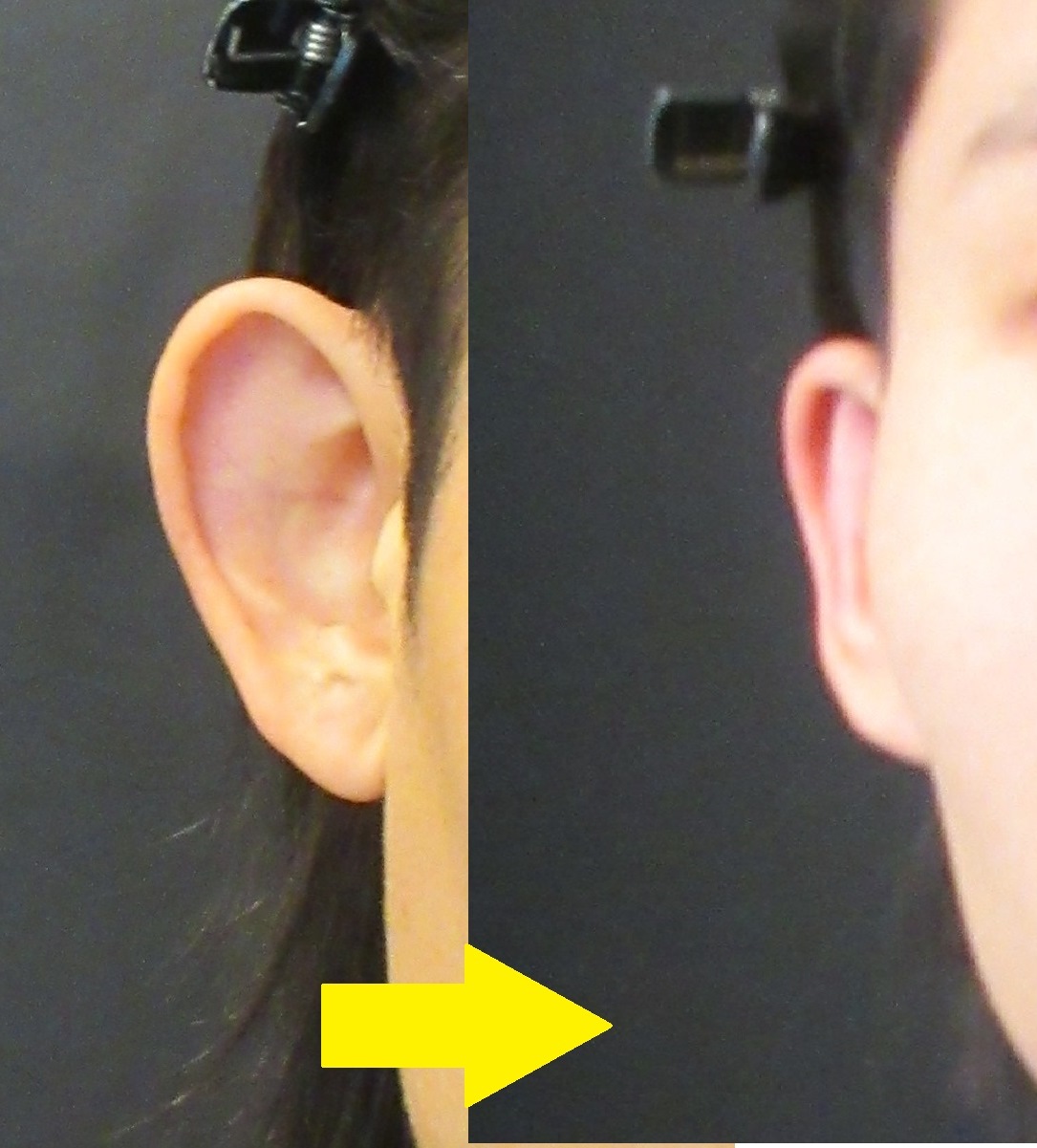 Cases covered by Japanese national insurance